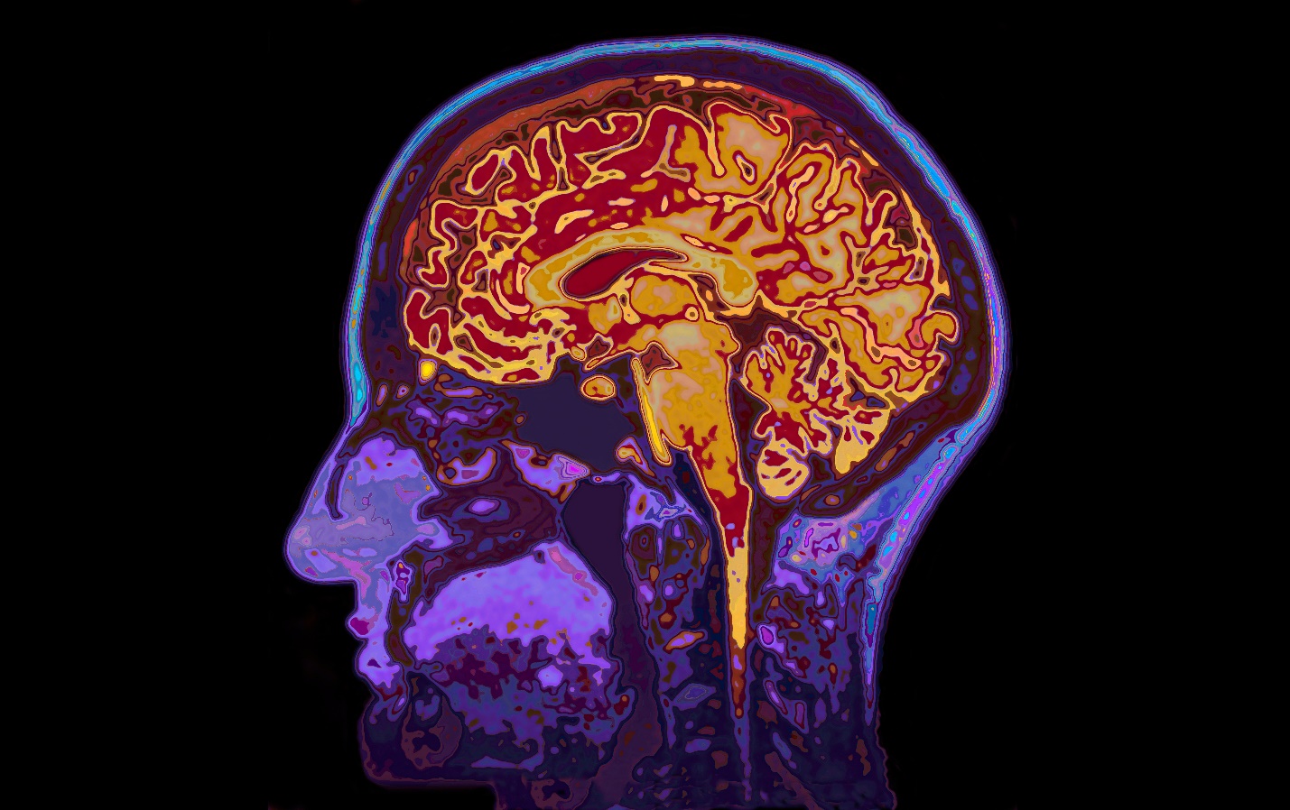 Imaging Tests for Various Neurological Problems | SHL