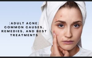 [Adult Acne] Common Causes, Remedies, and Best Treatments